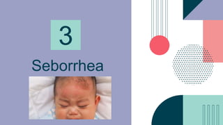 Penyulit dan Komplikasi Neonatus, bayi diaper rush, seborhea & oral ...