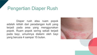 Penyulit dan Komplikasi Neonatus, bayi diaper rush, seborhea & oral ...