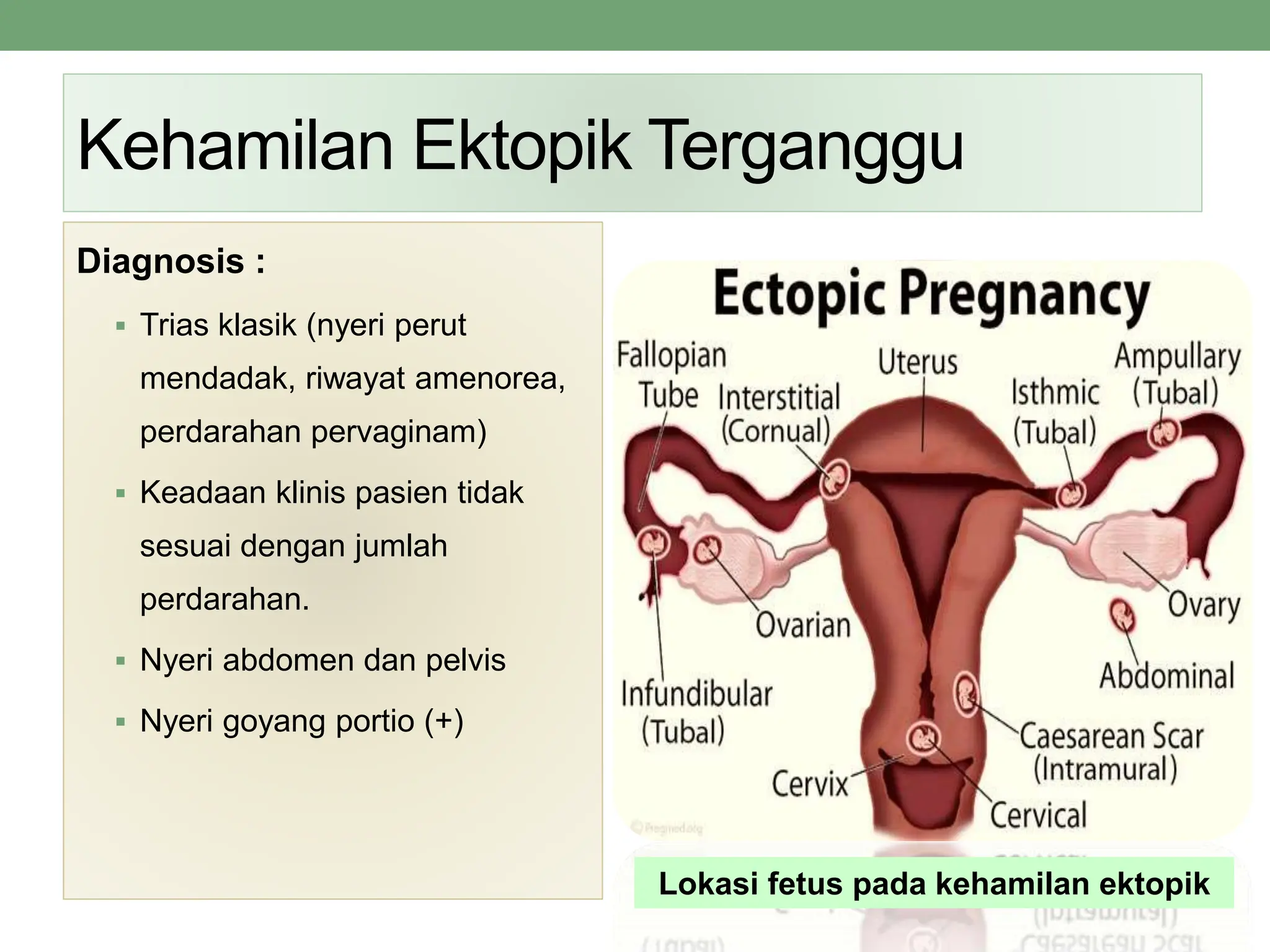 Tata laksana kehamilan dan persalinan dengan penyulit obstetri | PPT