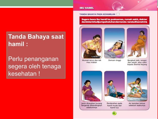 Tata laksana kehamilan dan persalinan dengan penyulit obstetri | PPT
