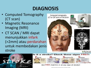 PPT Penyuluhan Kegiatan Prolanis Stroke Klinik | PPTX