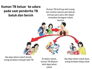penyuluhan-tb.pptx
