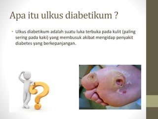 Penyuluhan-Ulkus-Dm-Bedah.pptx