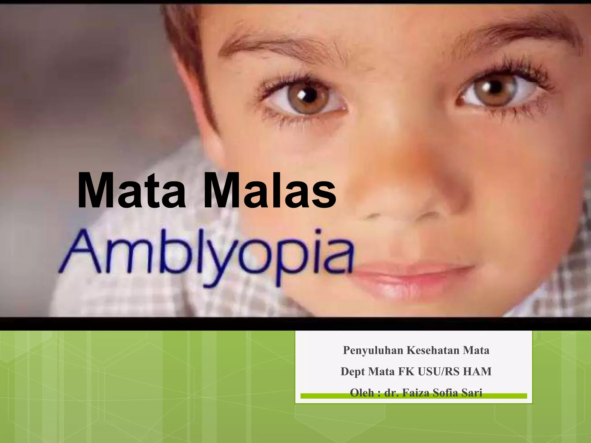 ambliopia | PPTX