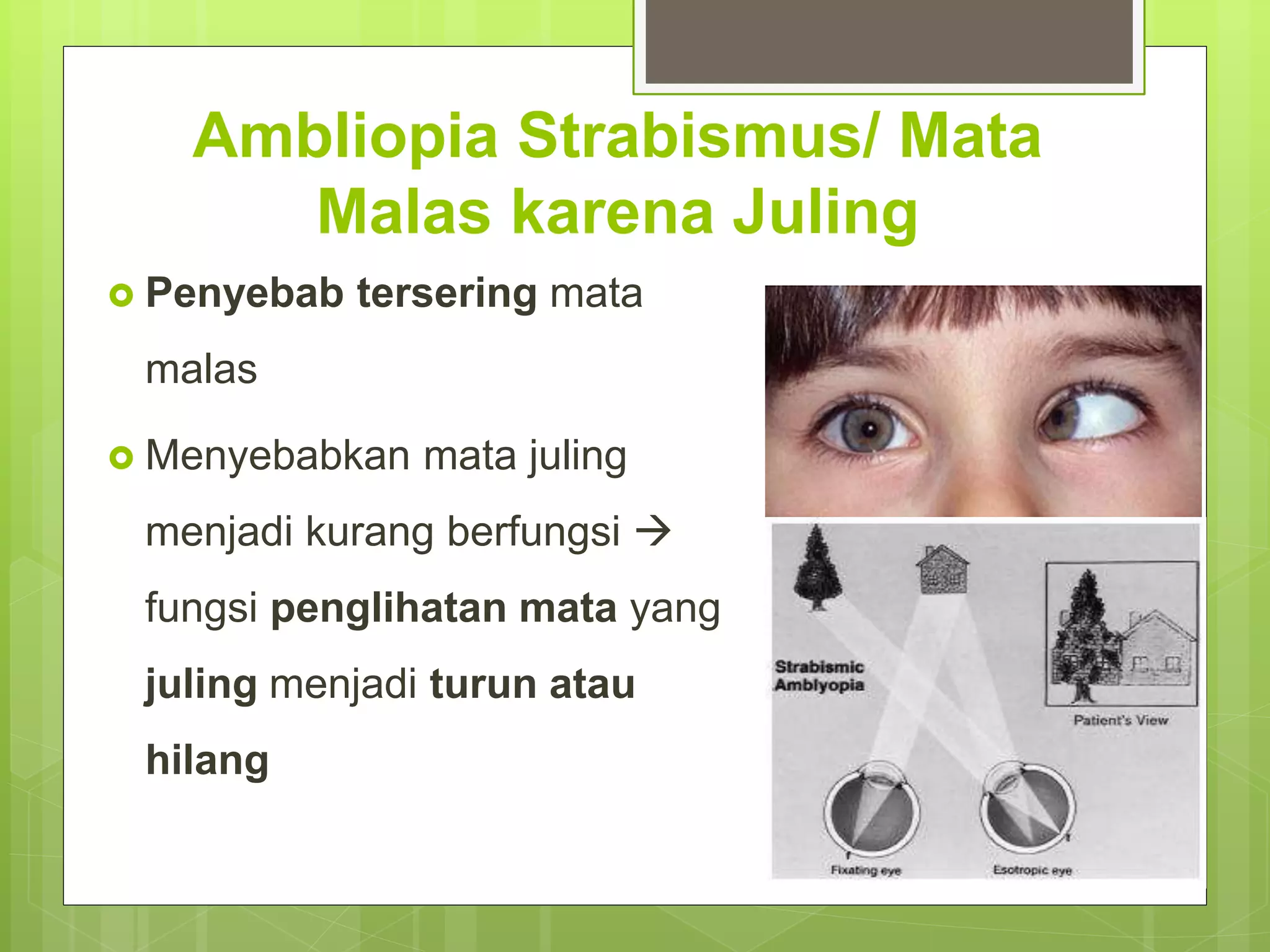 ambliopia | PPTX