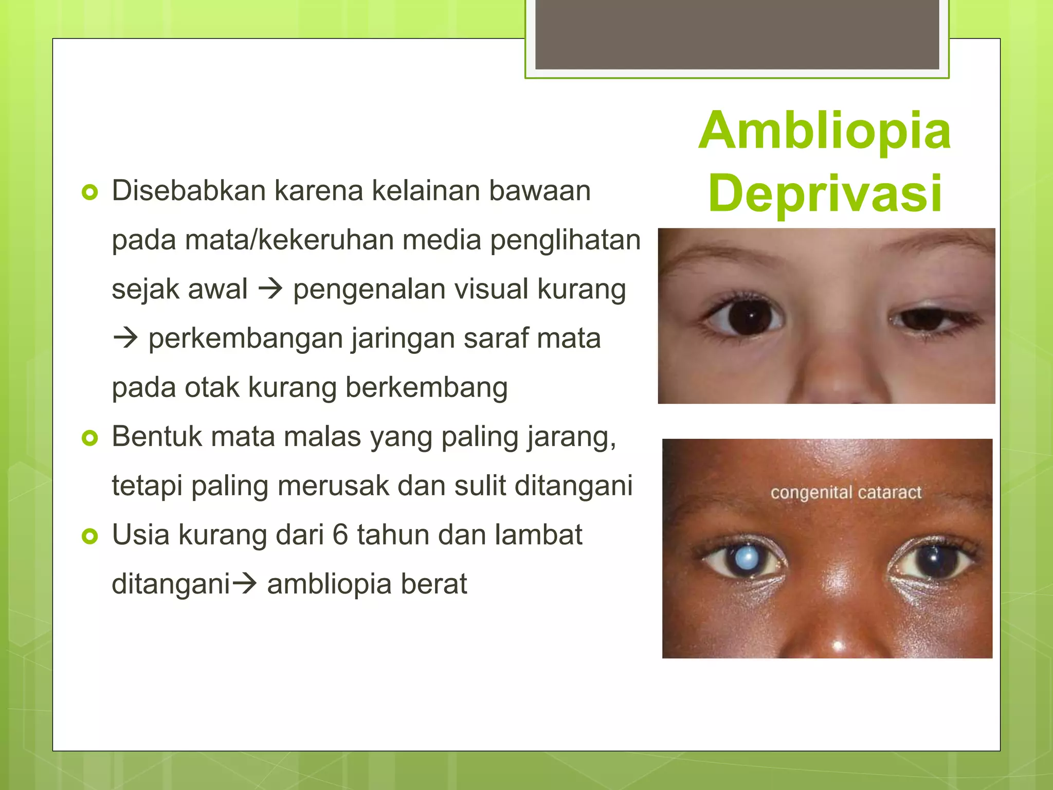 ambliopia | PPTX
