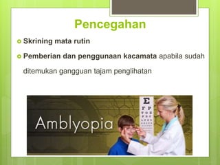 ambliopia | PPTX