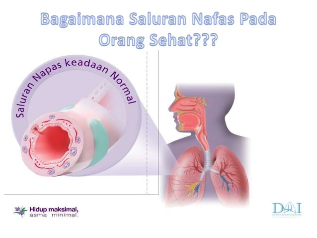 penyuluhan asma.pptx, pencegahan terhadap serangan asma | PPTX