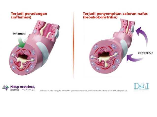 penyuluhan asma.pptx, pencegahan terhadap serangan asma | PPTX