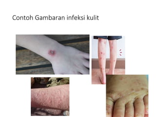 PENYULUHAN CUCI TANGAN untuk anak sekolah dasar | PPT
