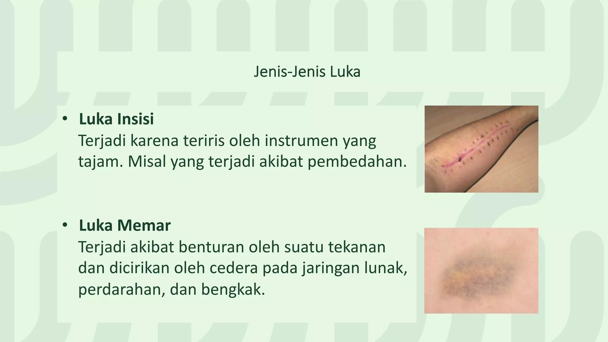 Penyuluhan Cuci tangan dan Perawatan Luka.pdf