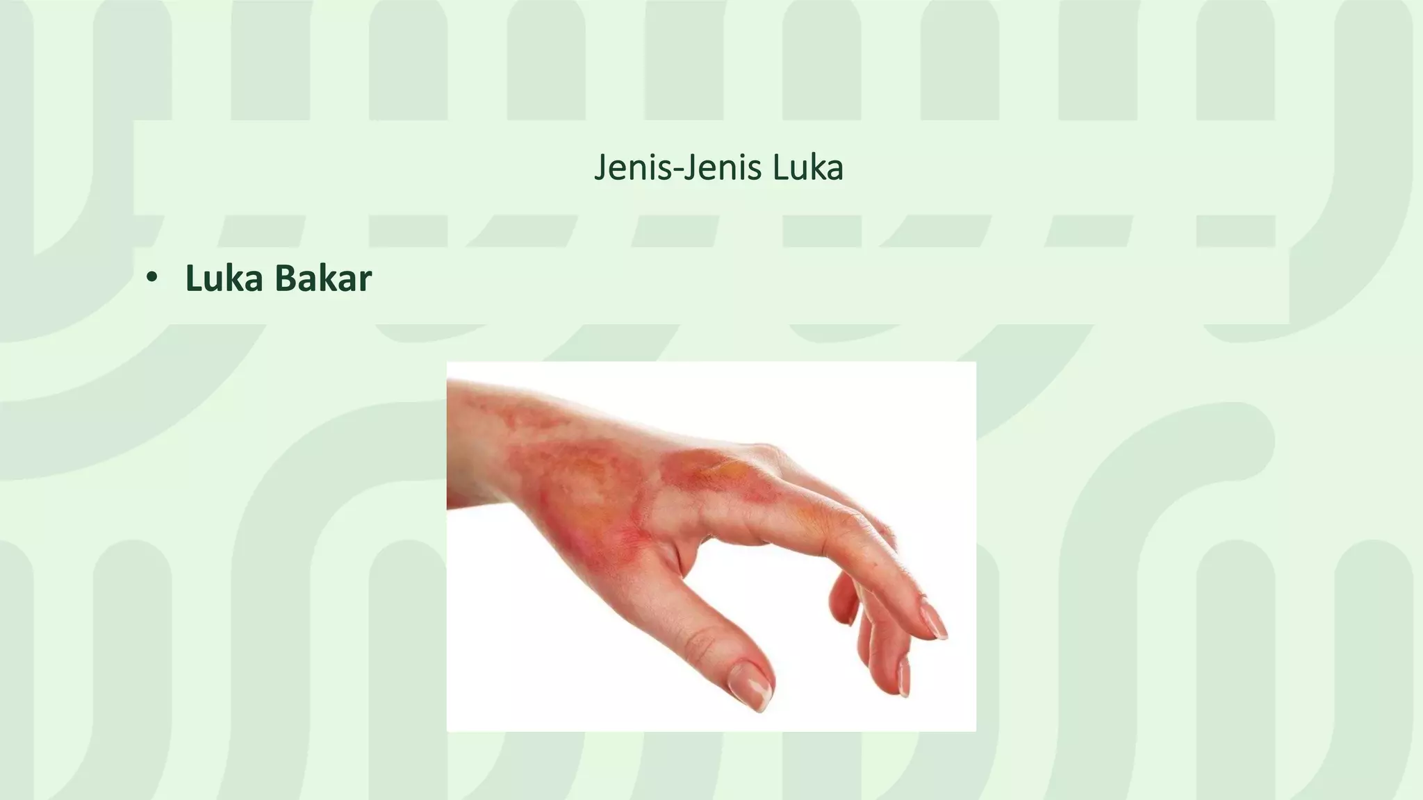 Penyuluhan Cuci tangan dan Perawatan Luka.pdf