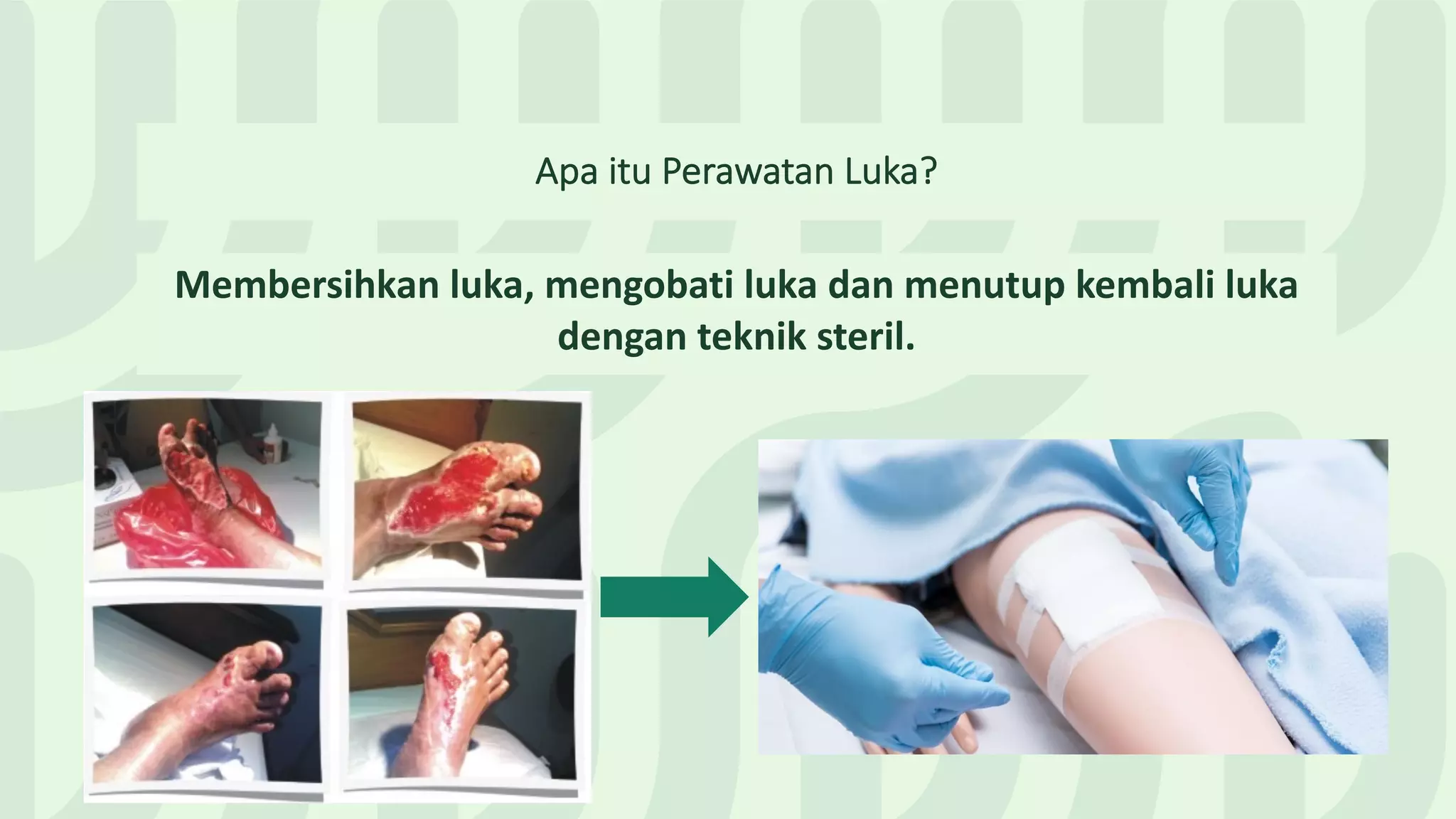 Penyuluhan Cuci tangan dan Perawatan Luka.pdf