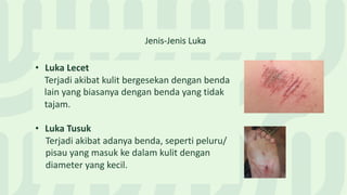 Penyuluhan Cuci tangan dan Perawatan Luka.pdf