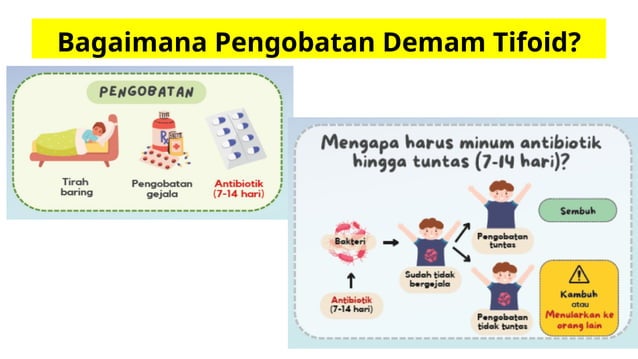 Penyuluhan Demam Tifoid beserta Gejala, dan Pencegahan | PPTX