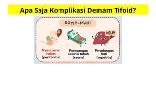 Penyuluhan Demam Tifoid beserta Gejala, dan Pencegahan | PPTX