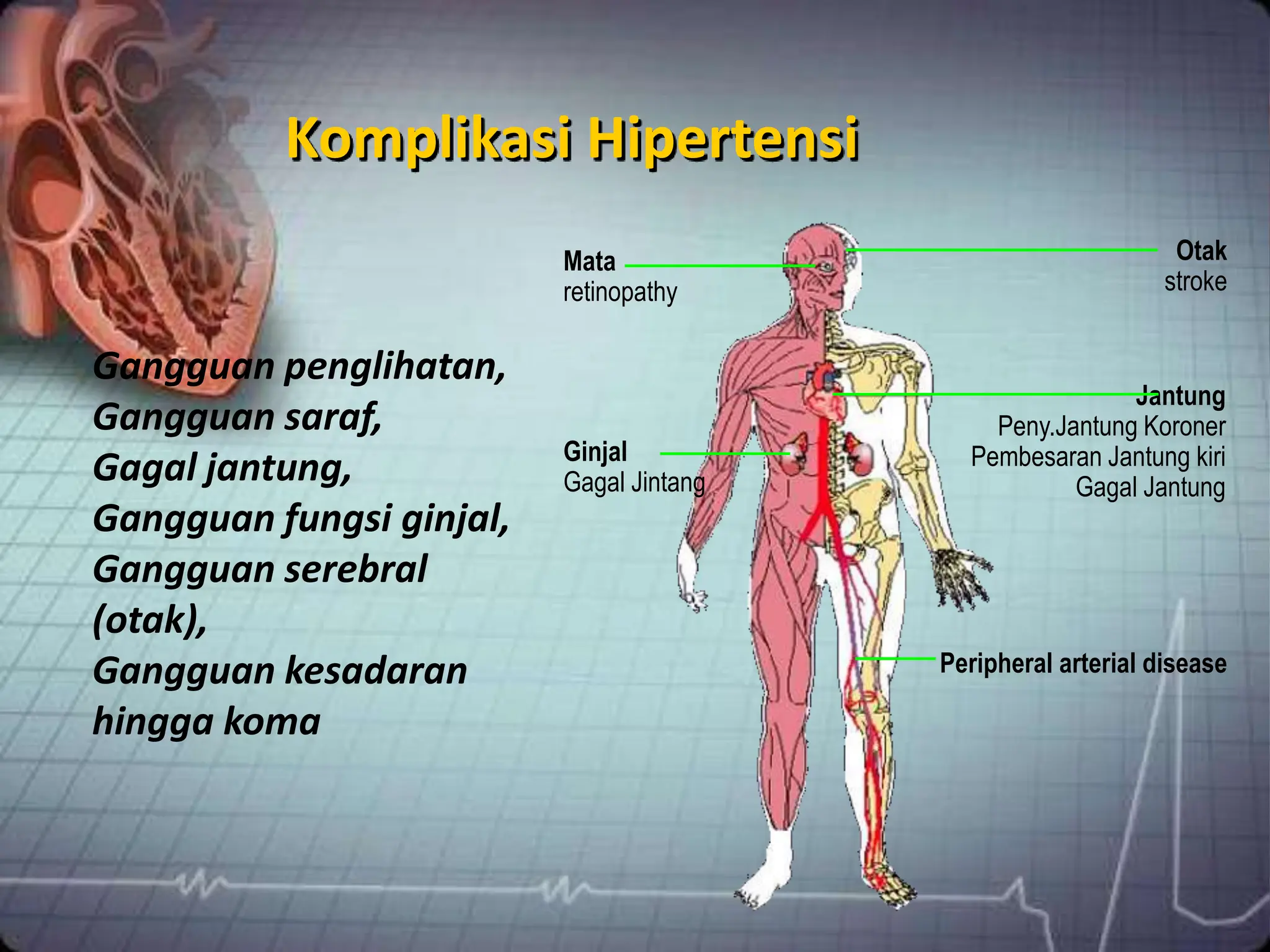 Penyuluhan_hipertensi.ppt