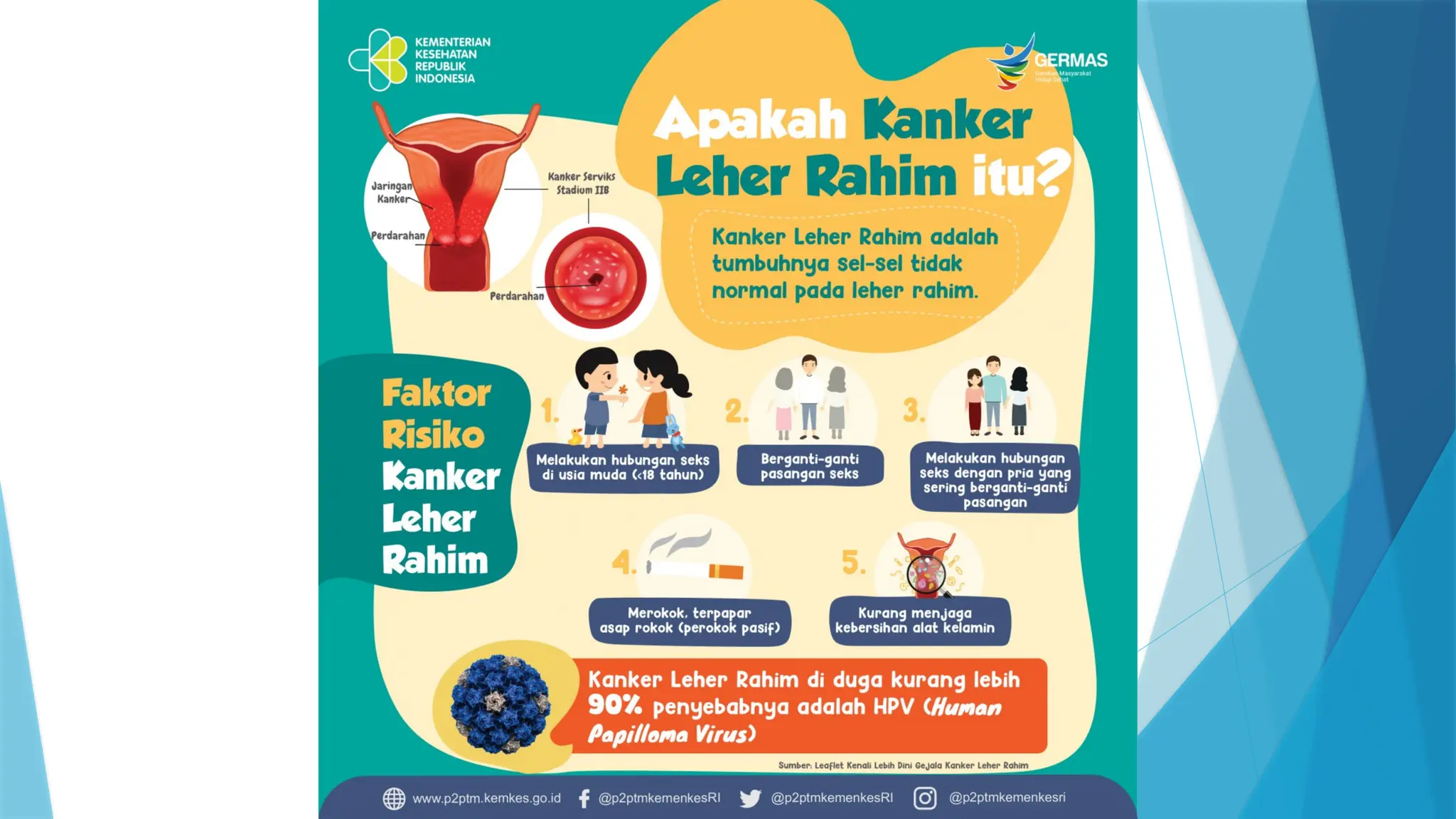 Penyuluhan Kanker Leher Rahim dan Pemeriksaan IVA | PPTX