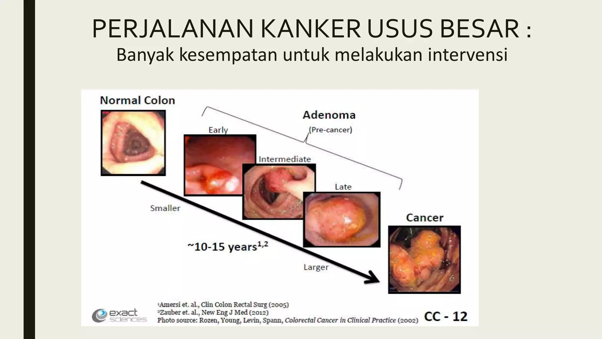 Penyuluhan kanker usus besar (dr. selonan) | PPTX