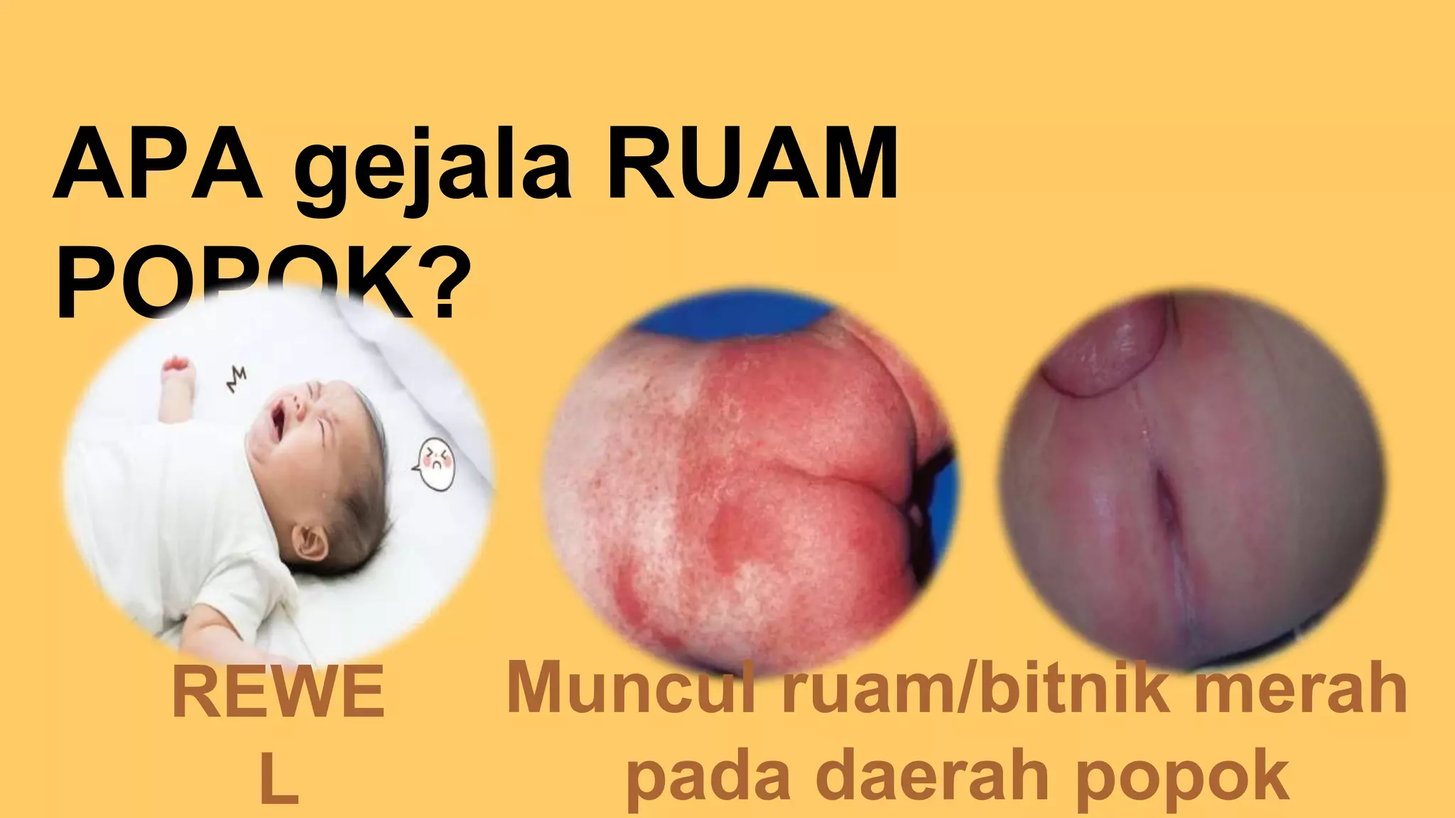 Penyuluhan Kel B.pptx