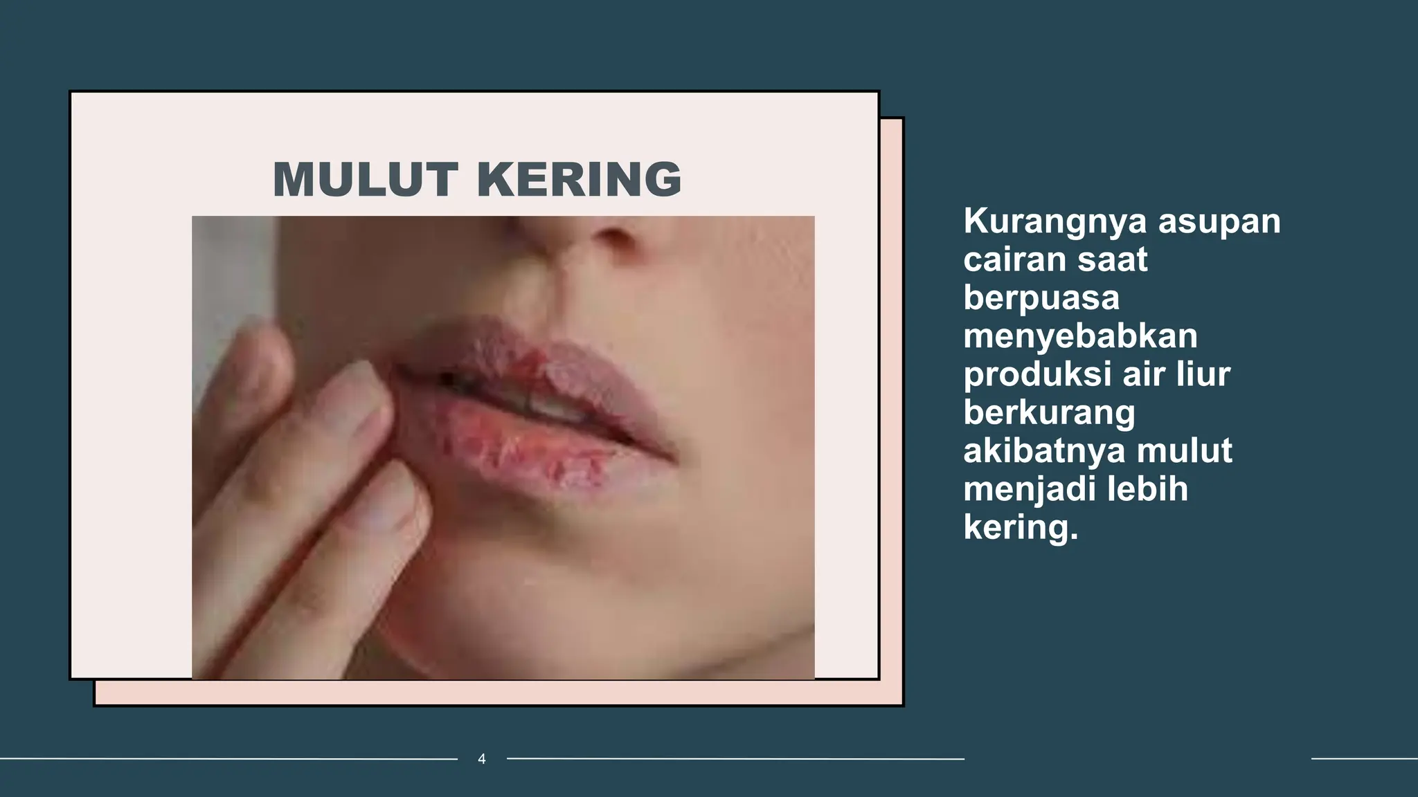 Penyuluhan Kesehatan gigi dan mulut.pptx