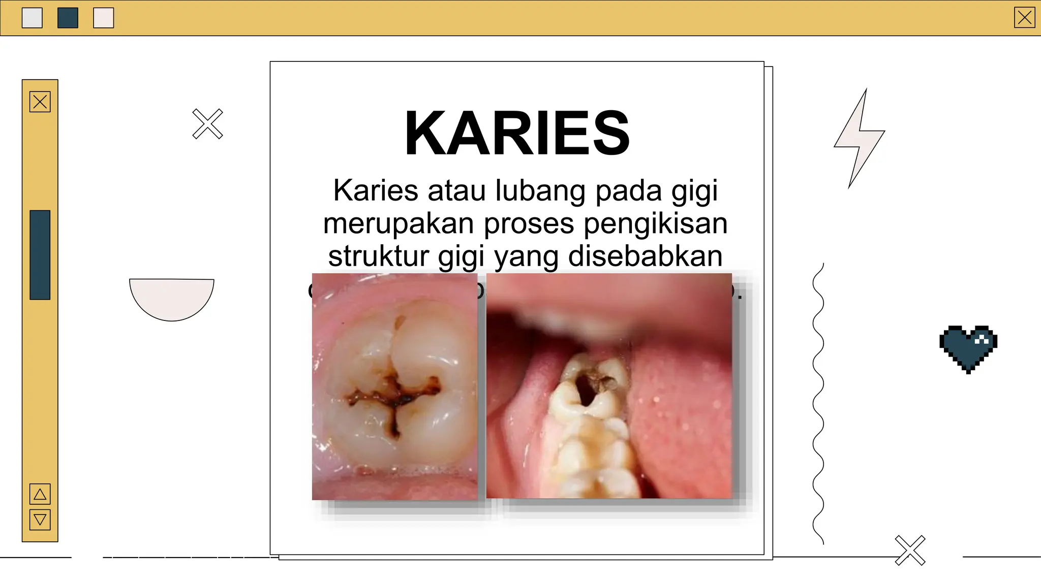 Penyuluhan Kesehatan gigi dan mulut.pptx