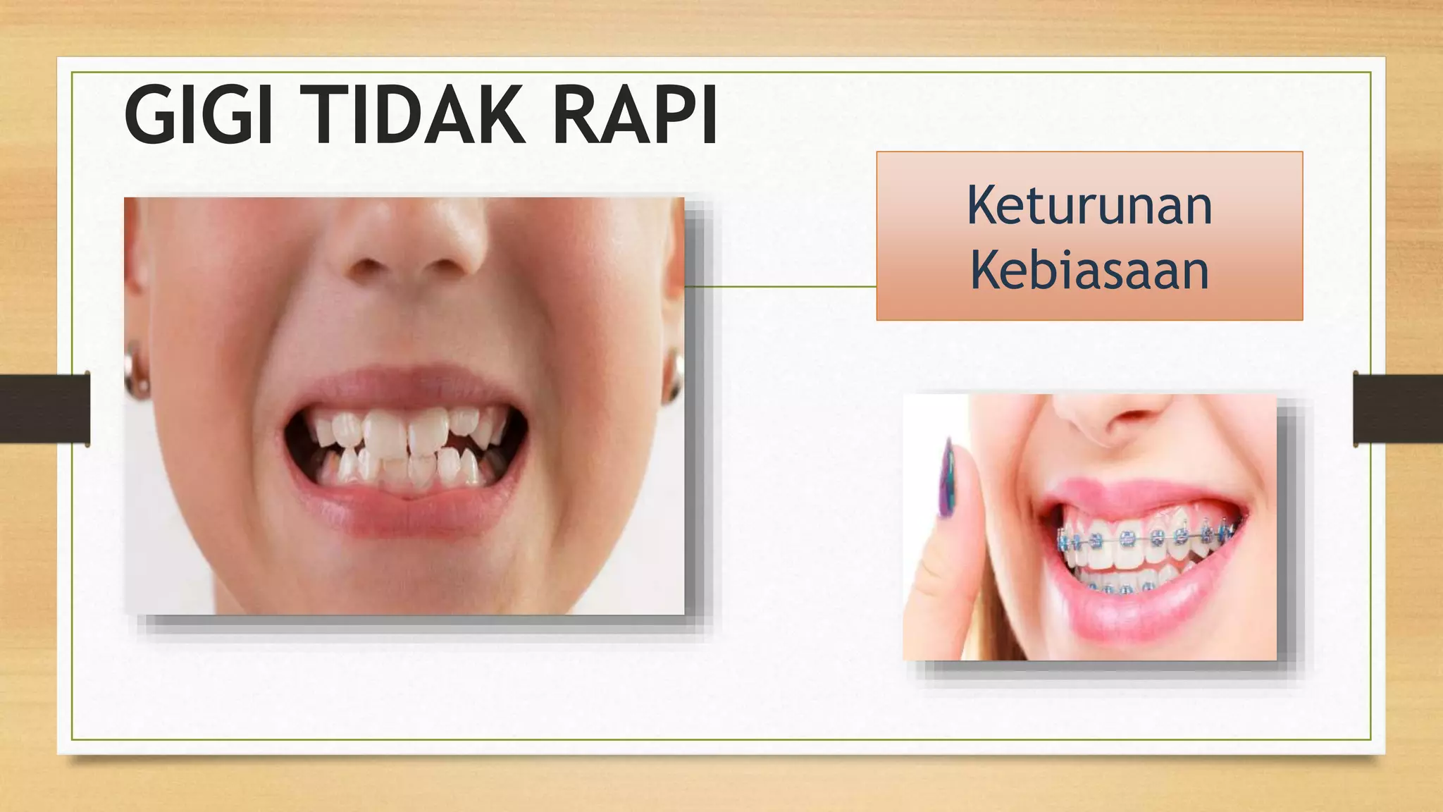 Penyuluhan Kesehatan Gigi dan Mulut Remaja | PPTX