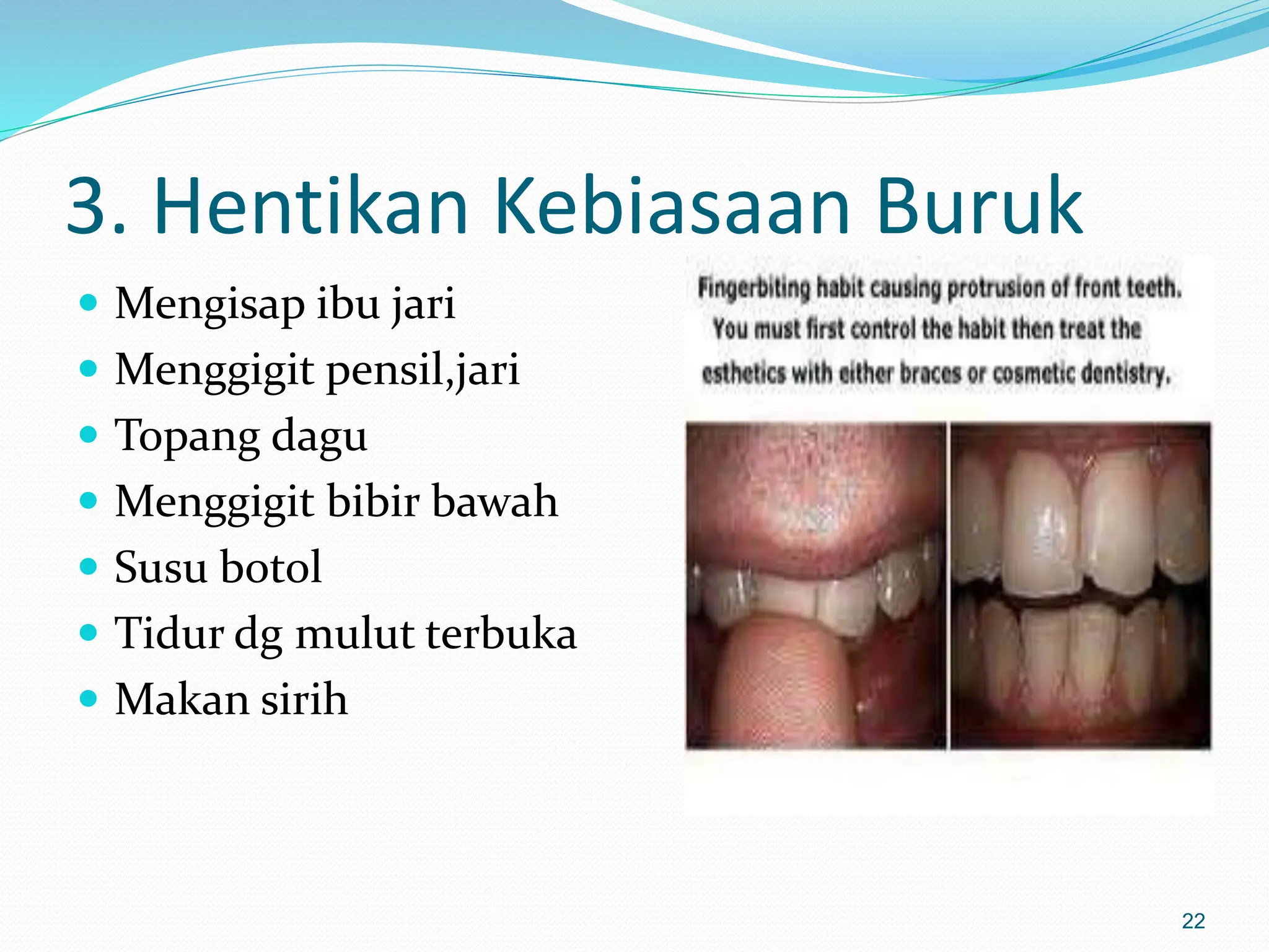 penyuluhan gigi dan mulut untuk sekolah.pptx