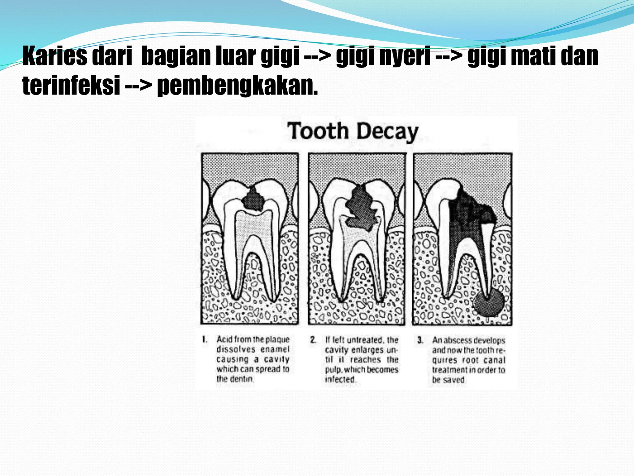 penyuluhan gigi dan mulut untuk sekolah.pptx