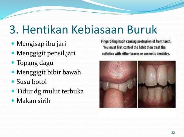 penyuluhan gigi dan mulut untuk sekolah.pptx