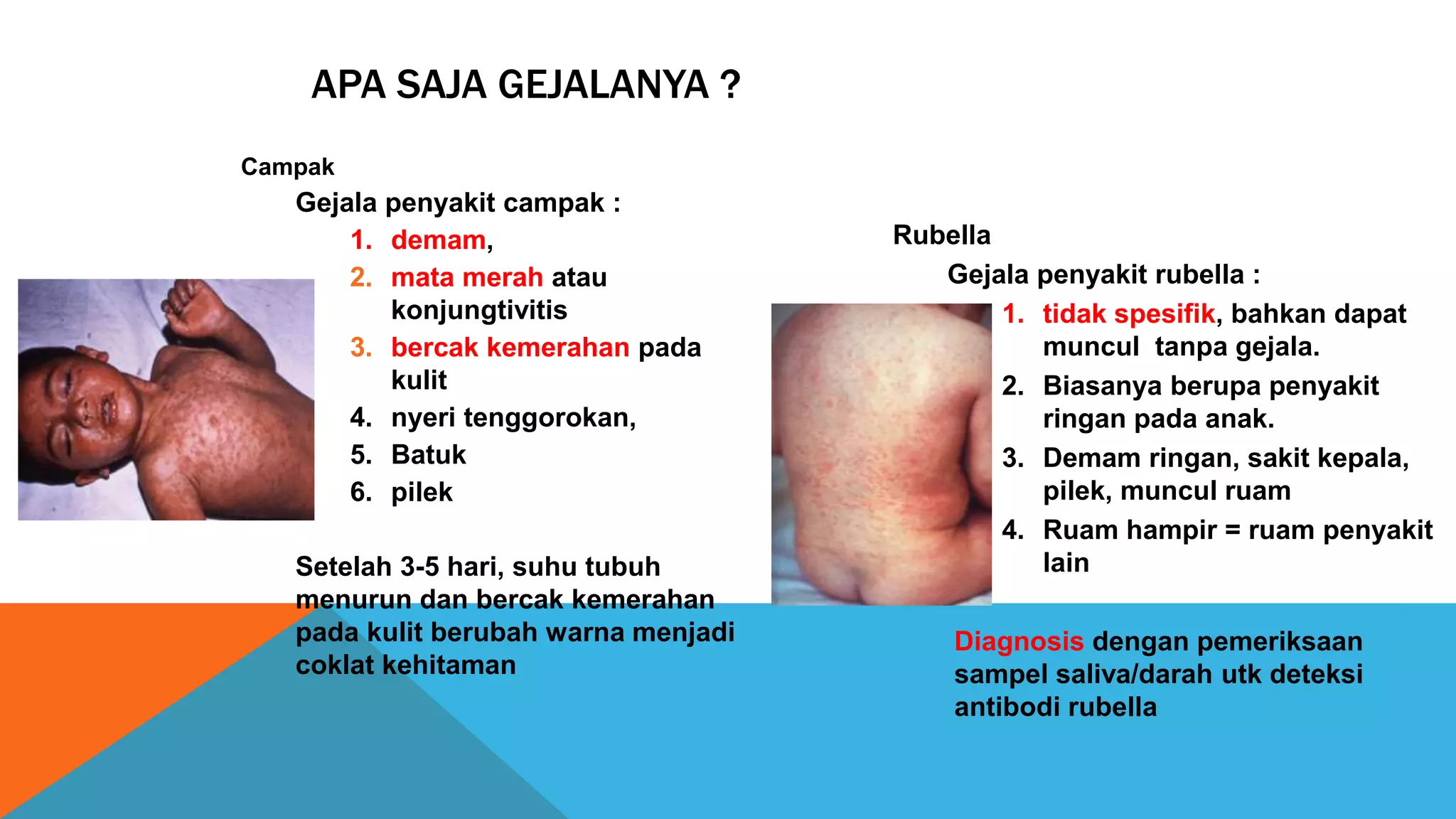 Penyuluhan Measles dan Rubella | PPTX
