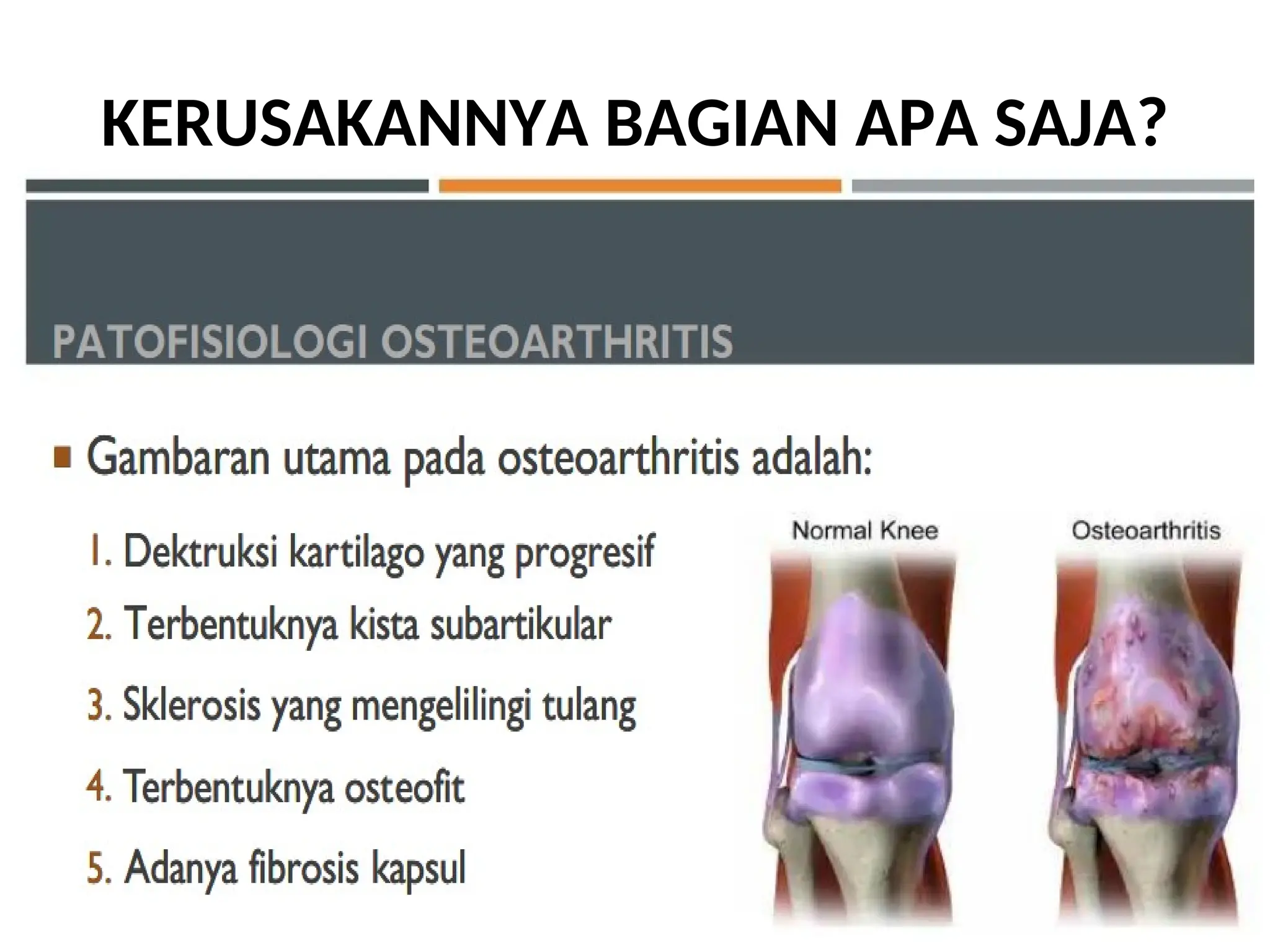 Penyuluhan OA prolanis, pada orang umum.ppt