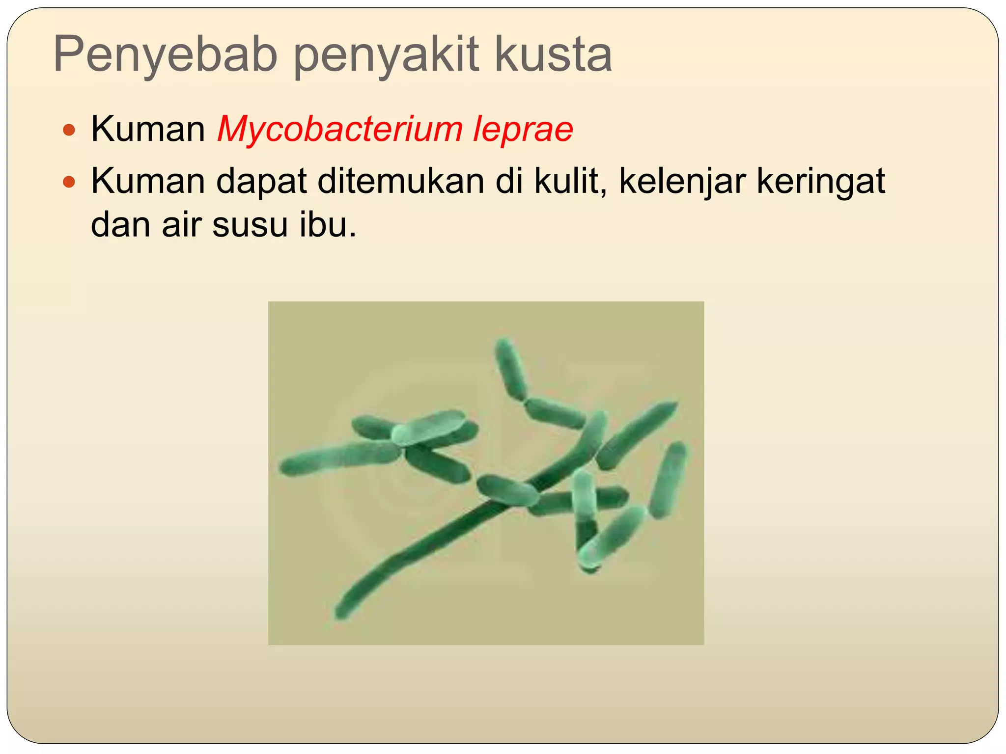 Penyuluhan_Penyakit_Kusta_1.pptx