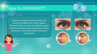 PENYULUHAN MENGENAL DAN PENANGANAN KATARAK .pptx