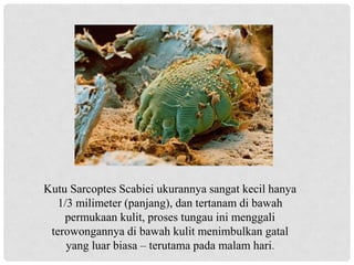 Penyuluhan Scabies.ppt