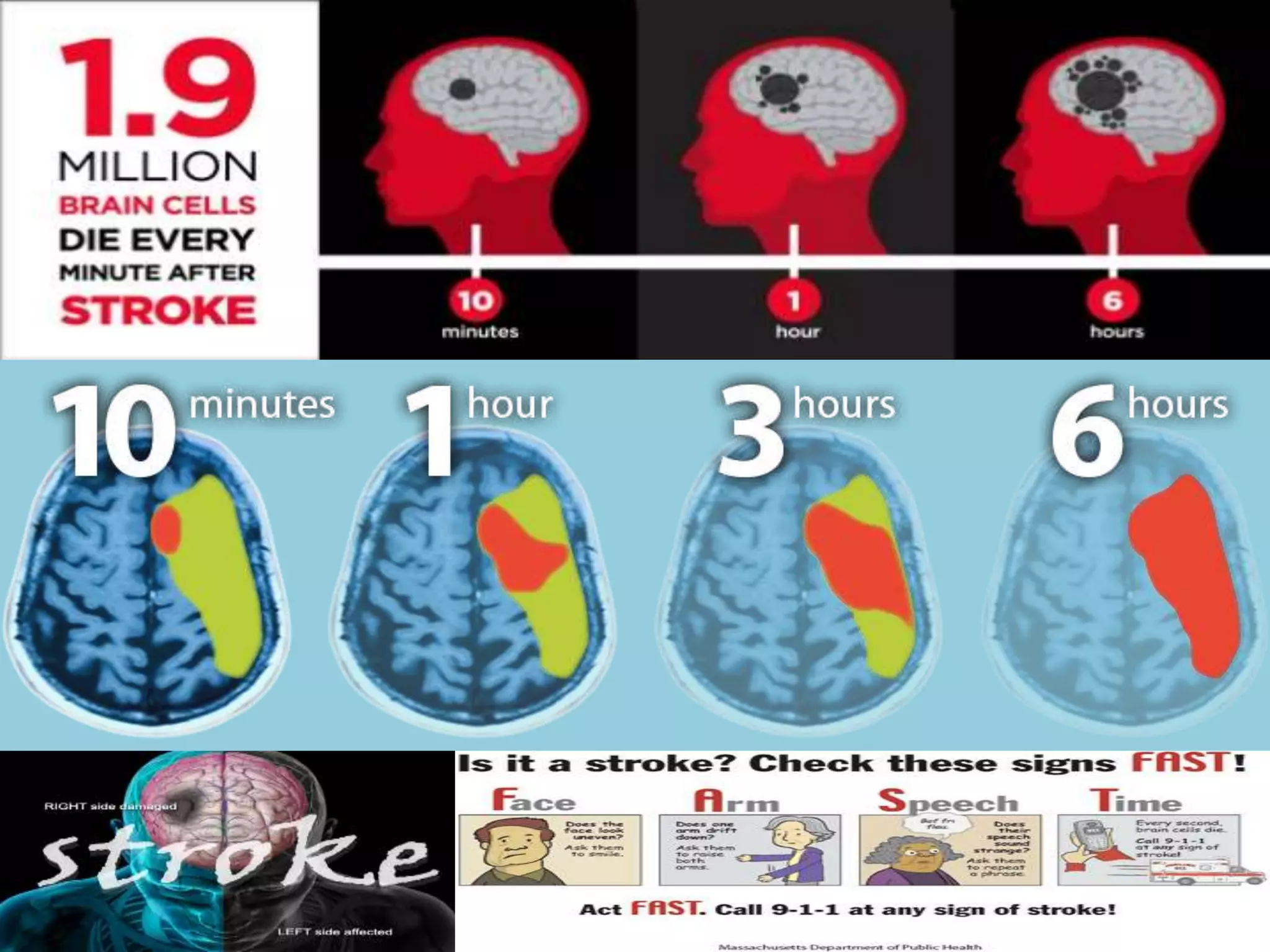 Penyuluhan_Stroke.pptx