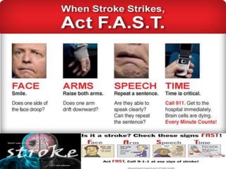 Penyuluhan_Stroke.pptx