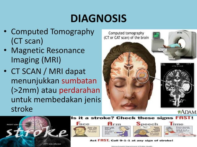 Penyuluhan_Stroke.pptx