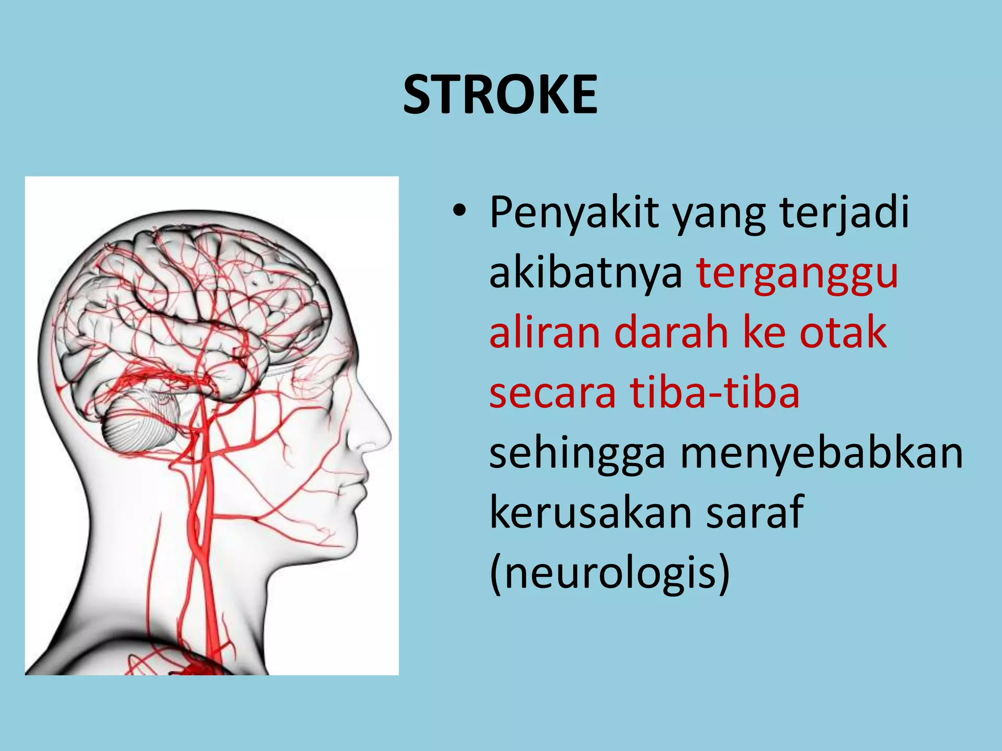 Penyuluhan_Stroke.pptx