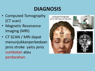 Penyuluhan_Stroke.pptx