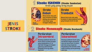 penyuluhan stroke (1).pptx