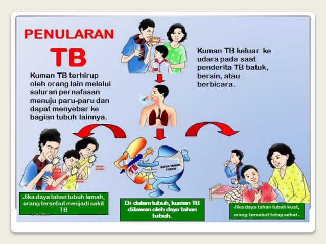 Penyuluhan tbc | PPTX