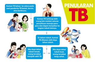 Penyuluhan TBC.pptx PENYULUHAN TUBERCULOSIS | PPTX