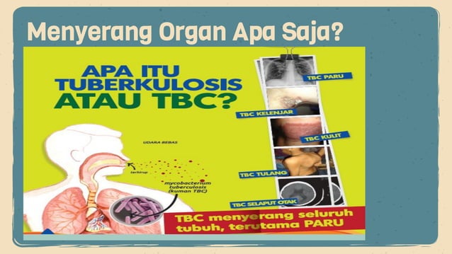 Penyuluhan TBC/ tuberkulosis / tb/mi.pdf