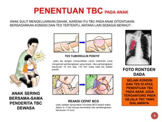 Penyuluhan_TB_pd_masyarakat (1).ppt