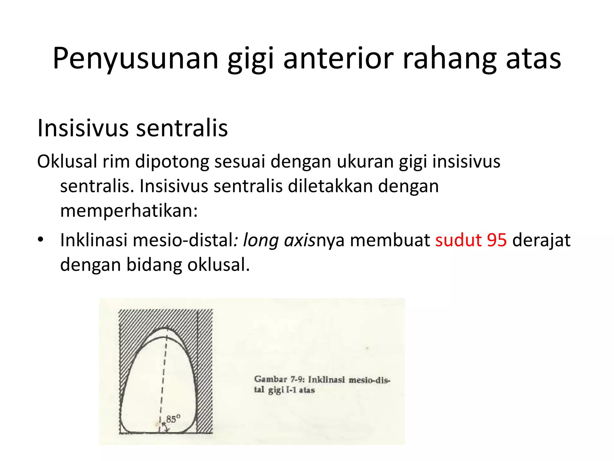 Penyusunan gigi anterior rahang atas | PPT