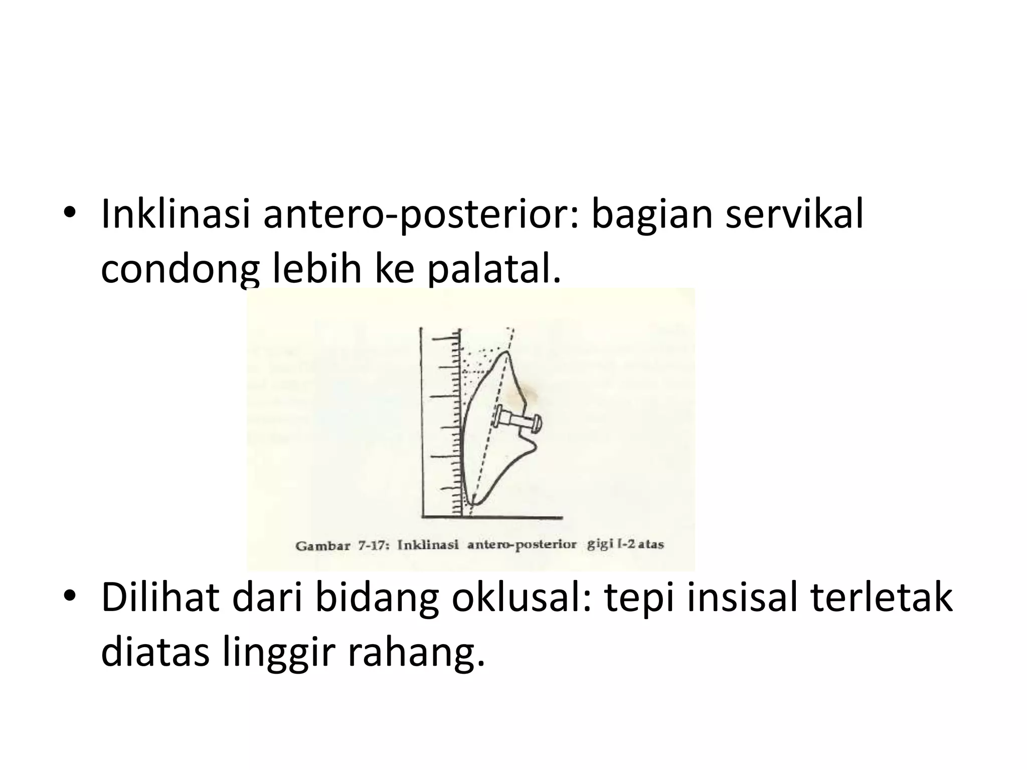 Penyusunan gigi anterior rahang atas | PPT