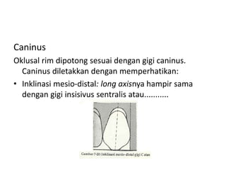 Penyusunan gigi anterior rahang atas | PPTX