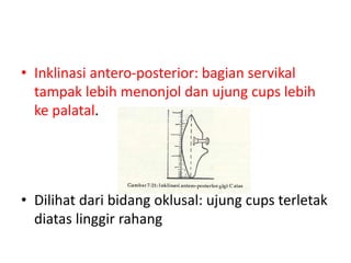 Penyusunan gigi anterior rahang atas | PPTX