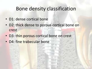 implant failure | PPTX